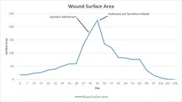 Pyoderma Gangrenosum - Best Wound Practice