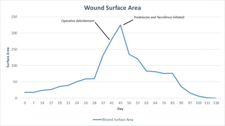 Pyoderma Gangrenosum - Best Wound Practice